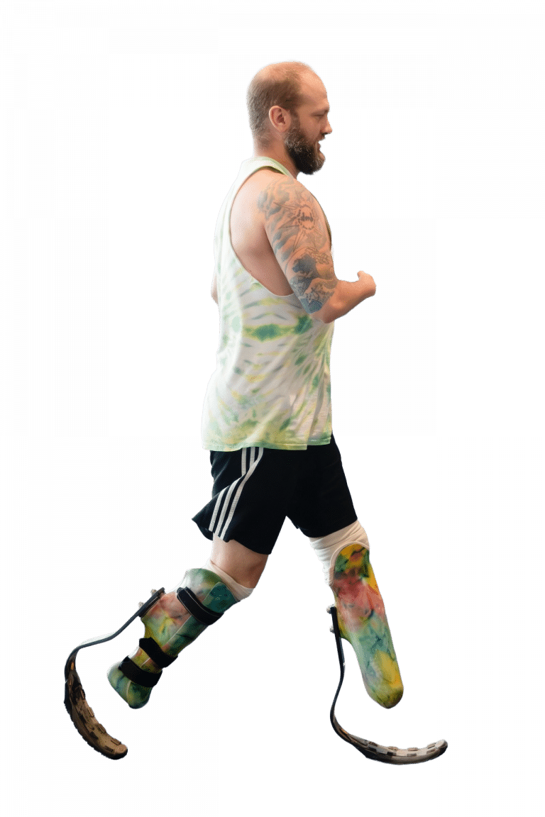 Transtibial Prosthesis Below‑Knee Prosthetic Solutions - Limb Lab