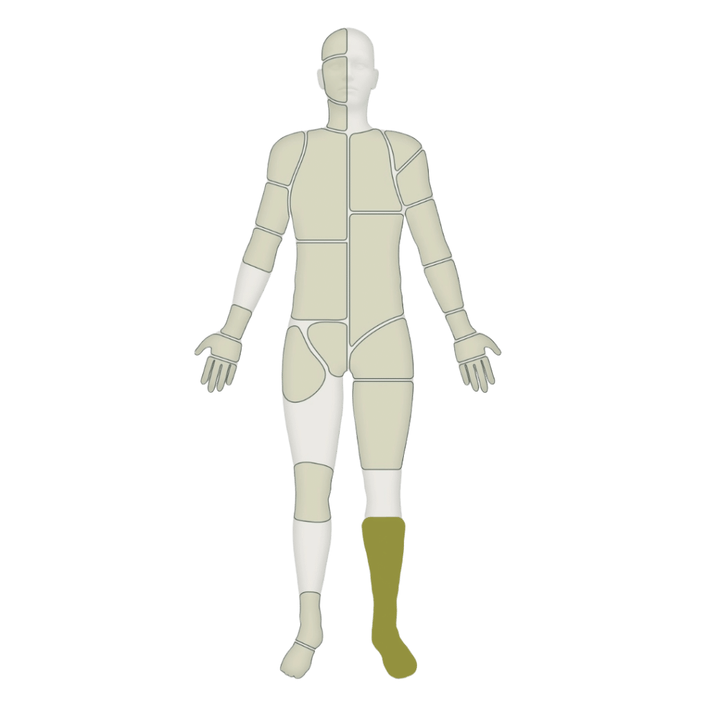 Transtibial Prosthesis Below‑Knee Prosthetic Solutions