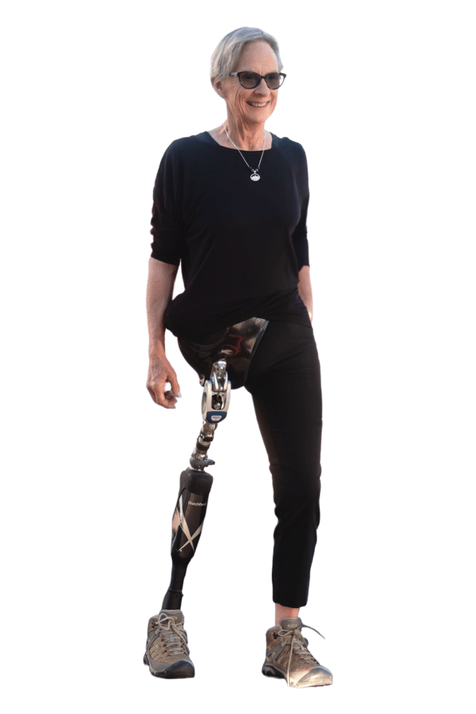 Hemipelvectomy and Hip Disarticulation Prosthetic Solutions